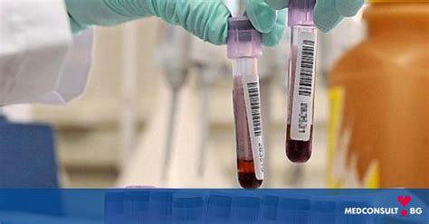 През декември безплатни изследвания за повишени нива на пикочна киселина във Варна и Бургас