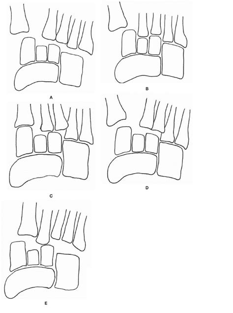 16 Classification Of Fractures And Dislocations Musculoskeletal Key