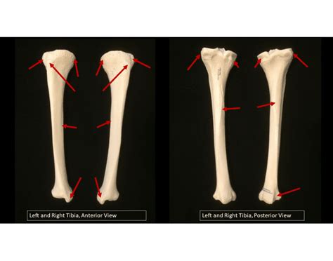 Left And Right Tibia Anterior And Posterior View Quiz