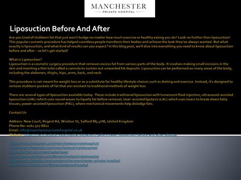 Ppt Liposuction Before And After Powerpoint Presentation Free