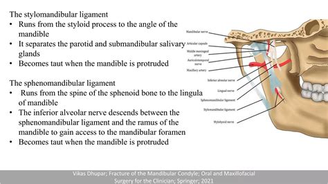 Condylar Fracture Pptx