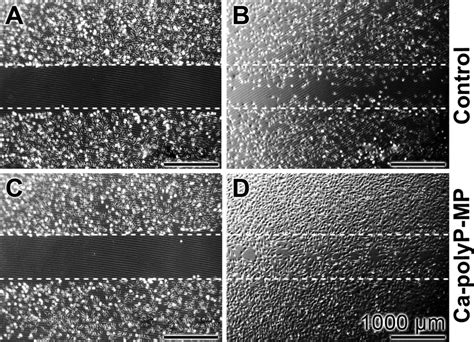 Analysis Of Endothelial Cell Migration Onto Ecm Extract Substratum By Download Scientific