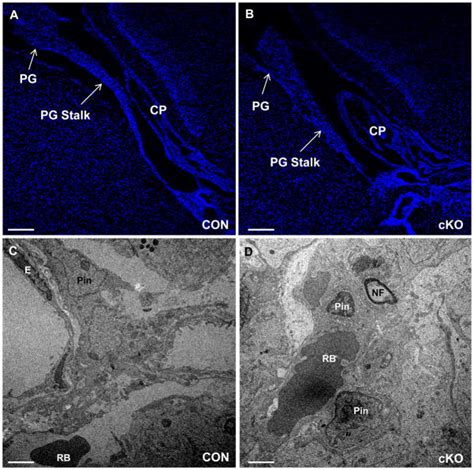 Neurod1 Is Required For Survival Of Photoreceptors But Not Pinealocytes
