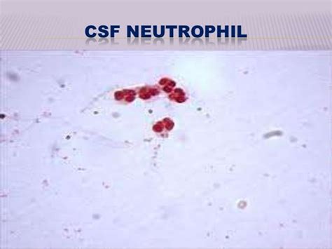 Evaluation Of Csf
