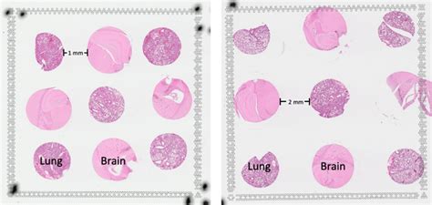 组织芯片（tma）能与10x Genomics Visium Cytassist Ffpe空间基因表达分析兼容吗？ 知乎