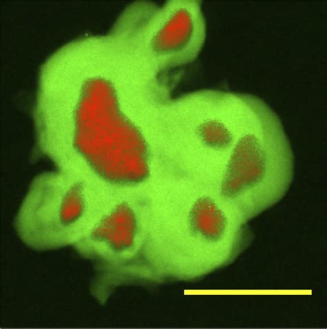Transmission Electron Microscopy Of Carbon Nanomaterials The Uwa