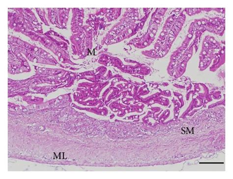 Histopathological Observations In Posterior Part Of Cobia Intestine