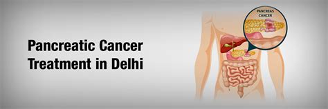 Best Pancreatic Cancer Treatment In Delhi Dr Asit Arora
