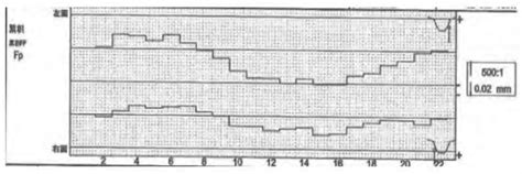 The Influencing Factors And Characteristics Of Spur Gear Transmission