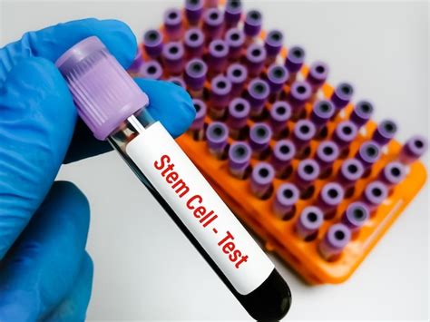 Premium Photo Blood Sample For Stem Cell Test In Research Laboratory