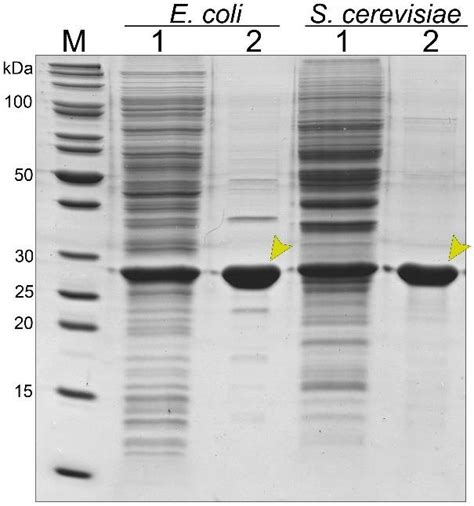 Sds Page Analysis Of Bacteria And Yeast Derived Recombinant Gp39