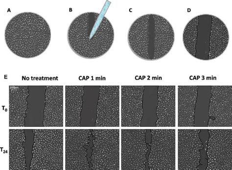 In Vitro Scratch Wound Healing Assay Method A Cells Were Seeded In A