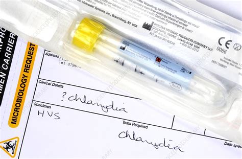 Vaginal Swab Kit For Chlamydia Test Stock Image C029 7917 Science Photo Library