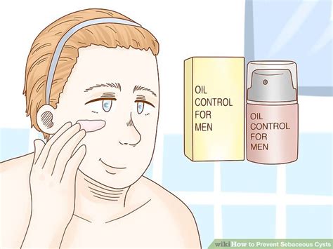 3 Simple Ways To Prevent Sebaceous Cysts Wikihow