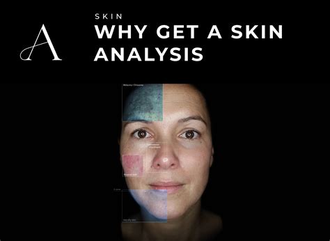 Why Get A Skin Analysis Aesthetics By Stephanie Livingston