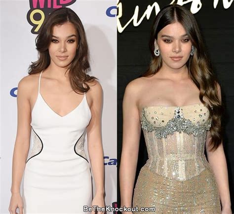 Hailee Steinfeld Plastic Surgery Comparison Photos