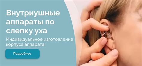 Внутриушные слуховые аппараты купить в Москве по выгодной цене