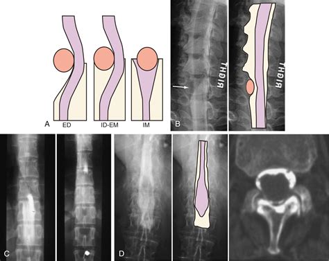 Radiology Of The Spine Clinical Tree