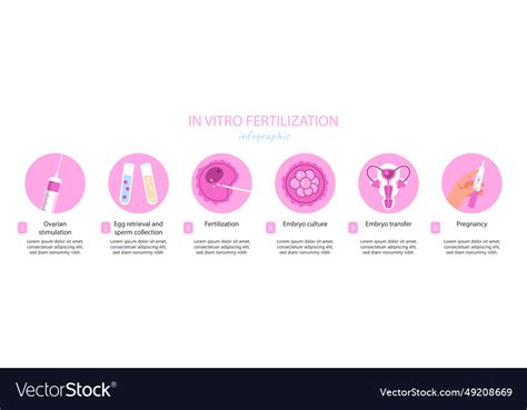 Ivf Infographic Concept Royalty Free Vector Image