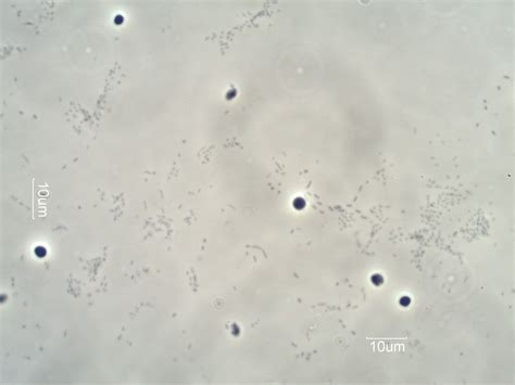 Biofilms In Drinking Water Under The Microscope