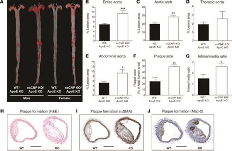 JCI Endothelial C Type Natriuretic Peptide Maintains Vascular Homeostasis