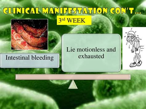 Typhoid Disease
