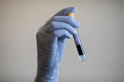 Oxford University Develops Blood Test To Detect Multiple Cancers At