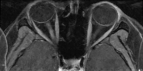American Board Of Ophthalmology On Linkedin Neuro Needs You—and Peds