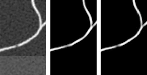 Figure 2 From A Novel Approach To Neurite Tracing In Fluorescence