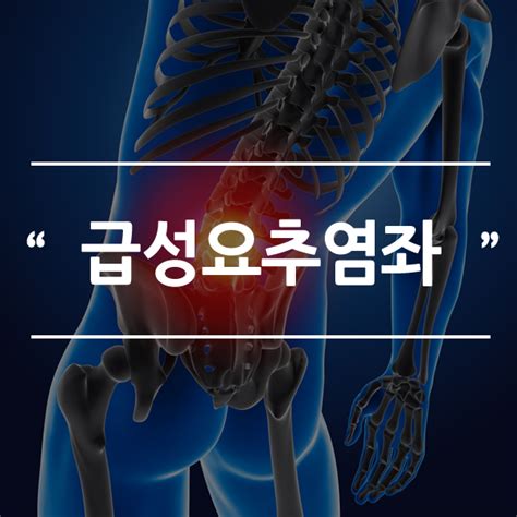 허리 삐끗 급성요추염좌는 초기치료가 중요해요 네이버 블로그