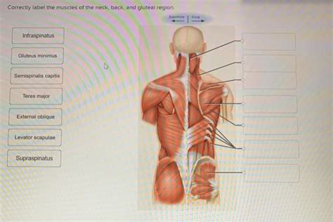 Solved Correctly Label The Following Muscles Of The Anterior