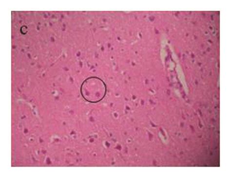 Microstructure Of Brain Tissue Under Light Microscope With 200 ×