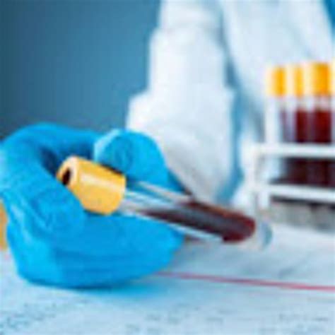 Stream Episode Exosome Markers Western Blot By Shaw Vivian Podcast