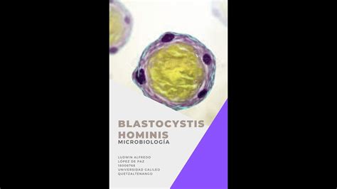 Blastocystis Sp YouTube