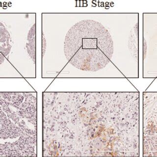 Examples Of GLUT Expression At Different Stages Of IHC Colon Download Scientific Diagram