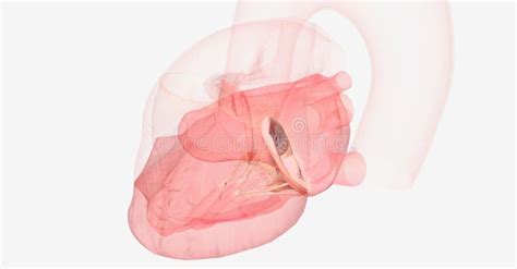 Mitral Valve Prolapse Occurs When The Heart Contracts And The Mi Stock