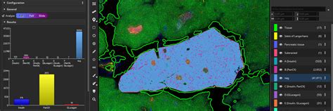 Mikaia Analysis Of Human Pancreas 4plex Scanned With Nanostring Geomx