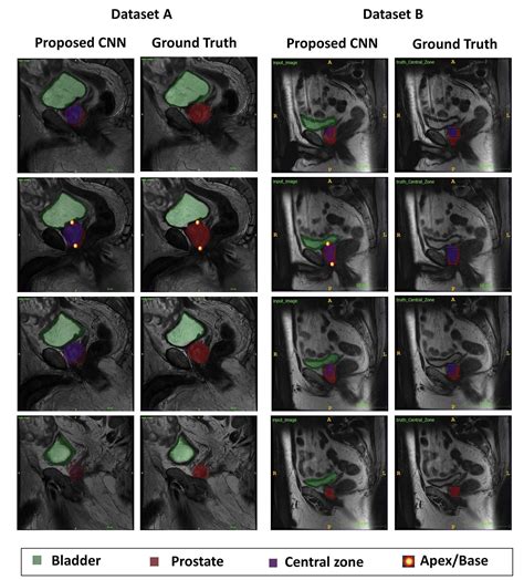 Multitasking Neural Networks For Multiplanar Mri Prostate Localization