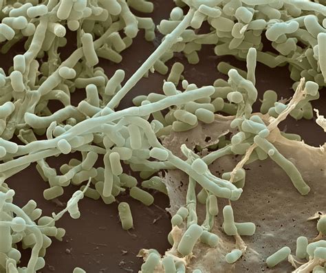 Streptomyces Sp Sem 1 Photograph By Oliver Meckes Eye Of Science