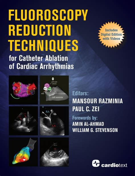 Fluoroscopy Reduction Techniques For Catheter Ablation Of Cardiac