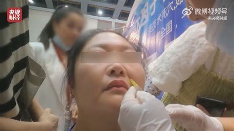 央视315曝光不可注射的美容针：10倍利润 或致毁容 快科技 科技改变未来