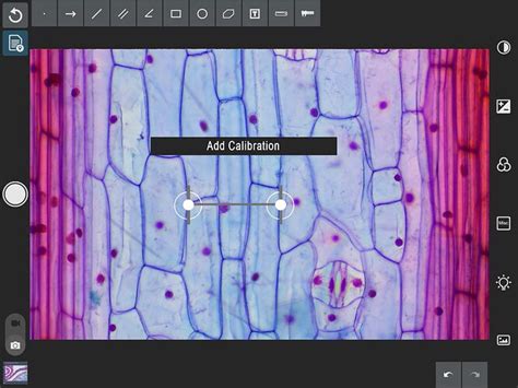 How Can I Identify The Size Of The Annotation Area In Mm² Qupath Image Analysis Imagesc Forum