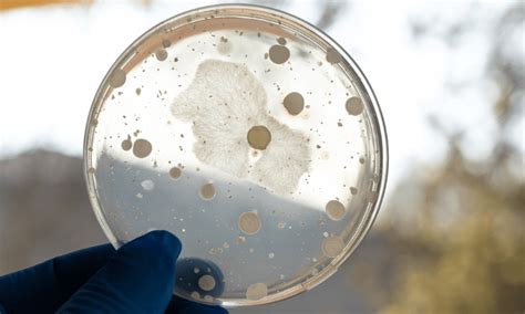 Laboratory Bacterial Culture Microbial Analysis And Identification Methods