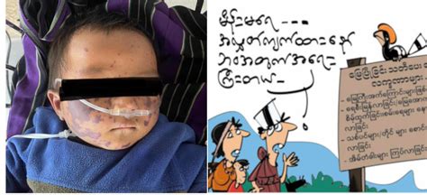 မင်းတပ်မှာ ရာသီတုပ်ကွေးအဖြစ်များနေပြီး ဒီနှစ်အတွင်း ၅ နှစ်အောက်ကလေး ၇ ဦးအထိ သေဆုံး နိုင်ငံတကာမ