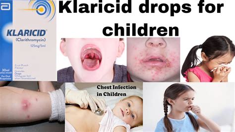 Klaricid Syrup Dose For 2 Year Old At Brayden Cooke Blog