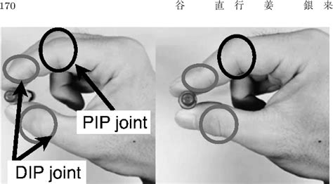 Figure From Development Of Joint Flexion Mechanism With Myoelectric Prosthetic Hand For Stable