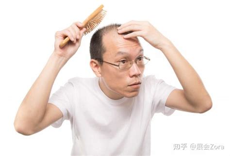 白头发是身体的警报？我不要长白头发！ 知乎