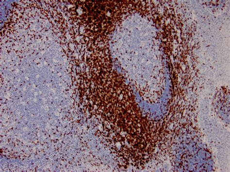 Cd3 Antibody Recombinant Ivd Zeta Corporation