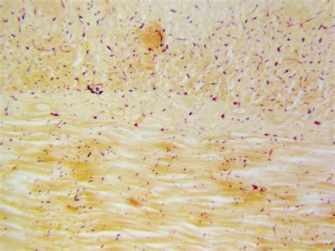 Intricate View Auerbach Plexus In The Small Intestine At 400x Stock