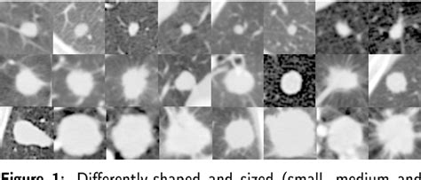 Figure 1 From Multi View Convolutional Recurrent Neural Networks For